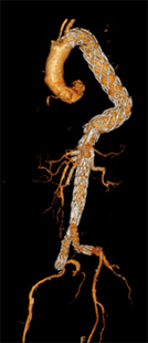 Vascular Surgery Research - Department of Surgery