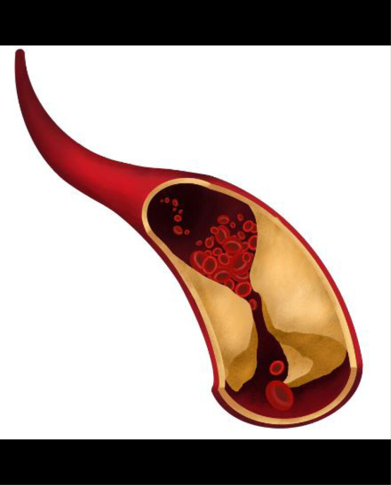 Vascular Surgery Research - Department of Surgery