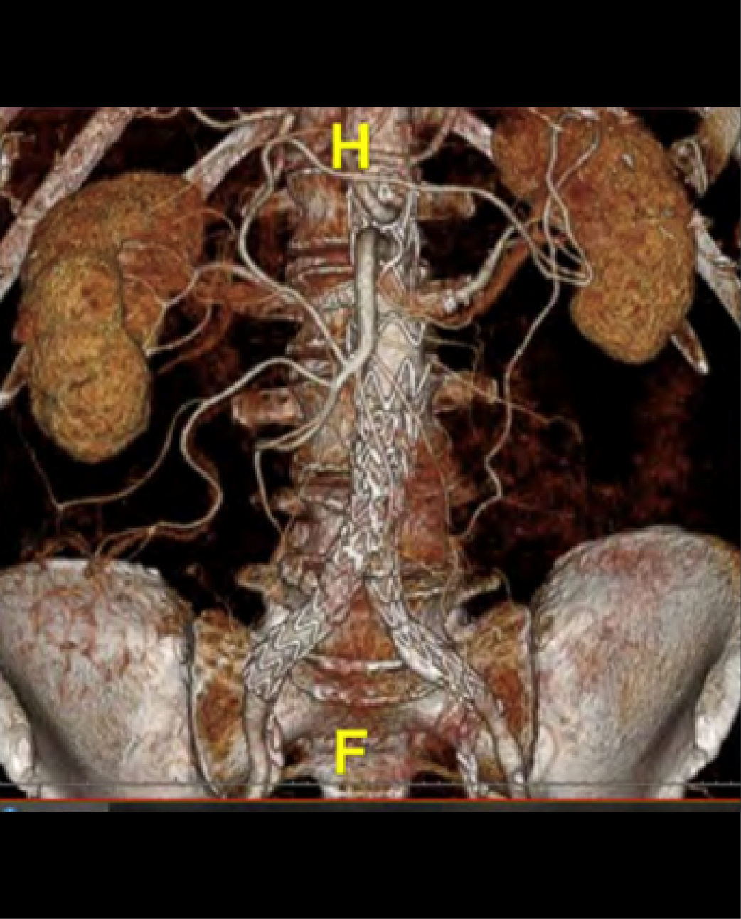 Vascular Surgery Research - Department of Surgery